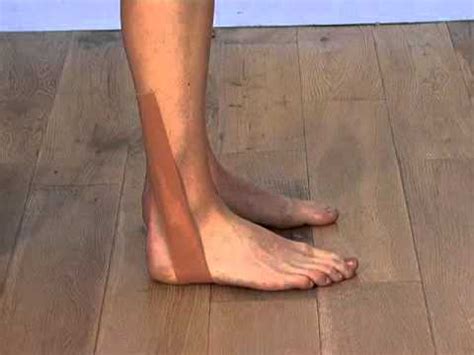 Peroneal Tendonitis Taping