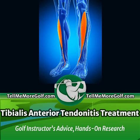 Tibialis Anterior Tendonitis Treatment Physical Therapist