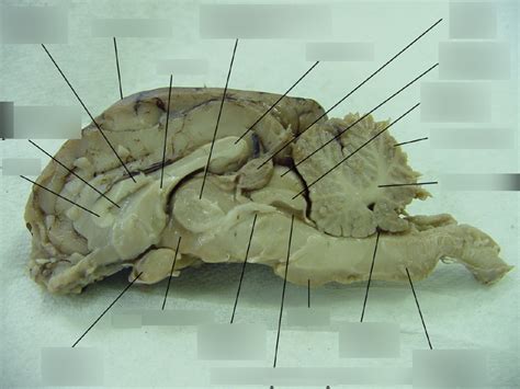 Sheep Brain 8 Diagram Quizlet