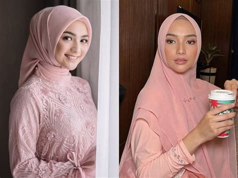 Deretan Seleb Yang Disebut Operasi Plastik Karena Wajah Terlihat Beda