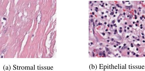 examples of heterogenous tissue compartments in the histopathological download scientific