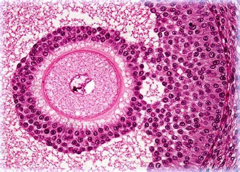 Ovary Slide Labeled Graafian Follicle