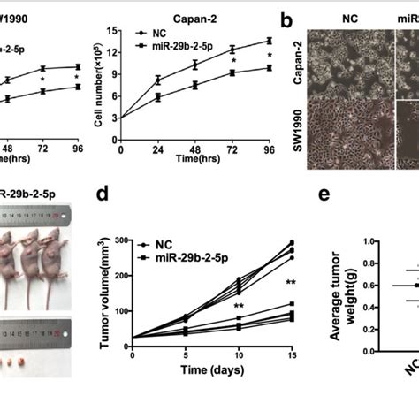 MiR 29b 2 5p Inhibits PDAC Cell Proliferation In Vitro And In Vivo