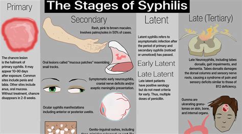 Complications Associated With Syphilis Syphilis Treatment