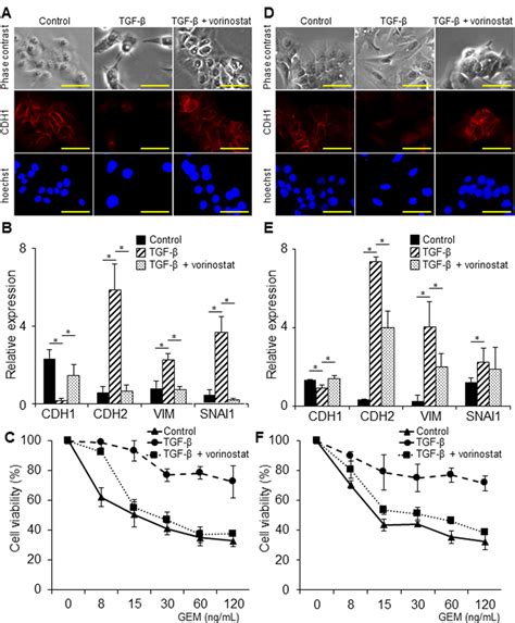Influence Of Vorinostat On Tgf Induced Emt And Chemoresistance In