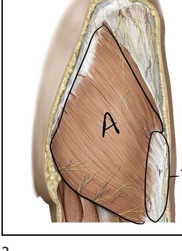 Gluteal Region And Posterior Thigh Flashcards Quizlet