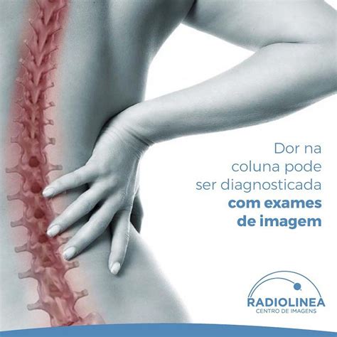 Dor na Coluna e o seu diagnóstico Radiolinea Centro de Imagens
