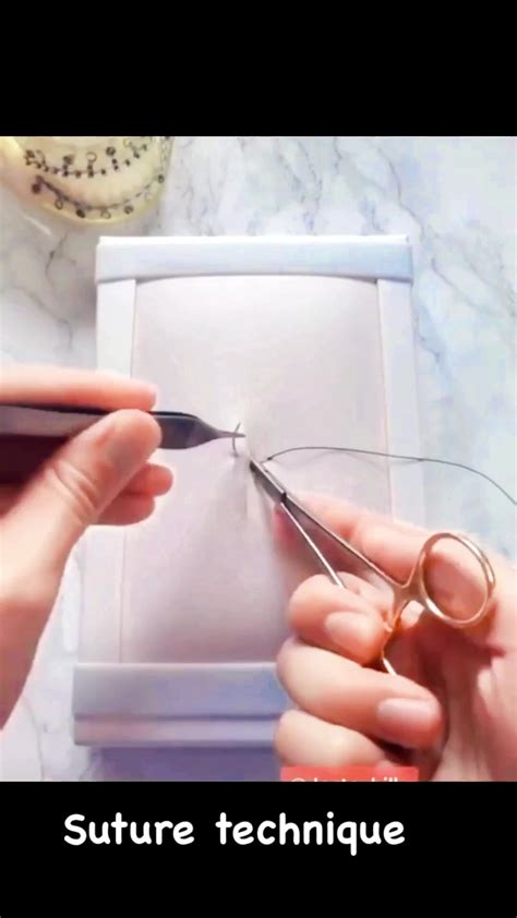 Suturing Technique Febspot