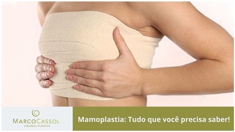 Mamoplastia Descubra Tudo Sobre O Procedimento Aqui