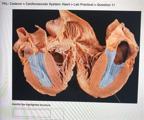 Solved Pal Cadaver Cardiovascular System Heart Lab Chegg