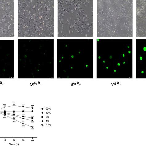 Colocalization Among Parkin Tom20 Indicated Mitochondria And