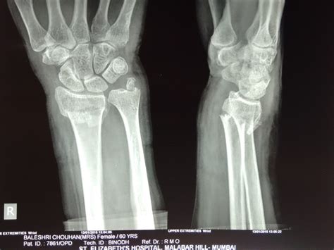 Case Bone Joint Clinic