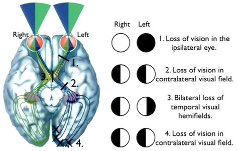 Neuro Physical Exam Flashcards Quizlet