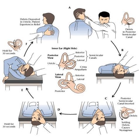 Barbecue Roll Horizontal Bppv Sante Blog