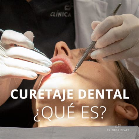 Curetaje dental qué es y por qué es necesario Clínica Pfaff