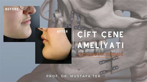 Ft Ene Amel Yati Prof Dr Mustafa Tek Youtube