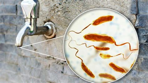 Kolera nedir nasıl bulaşır Deprem bölgesinde kolera salgını riskine