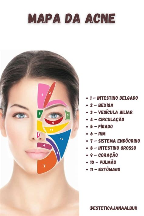 Espinhas No Rosto Significado Mapa Da Acne Acne Solutions Skin