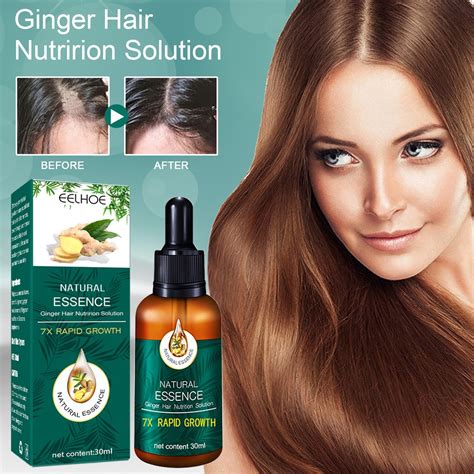 EELHOE 30ml Hair Growth Ginger Germinal Oil Essential Oil READY STOCK