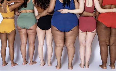 An Welchen Stellen Kann Cellulite Auftreten Dr Linde Blog