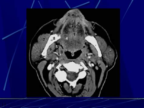 CT ANATOMY OF THE NECK SPACES