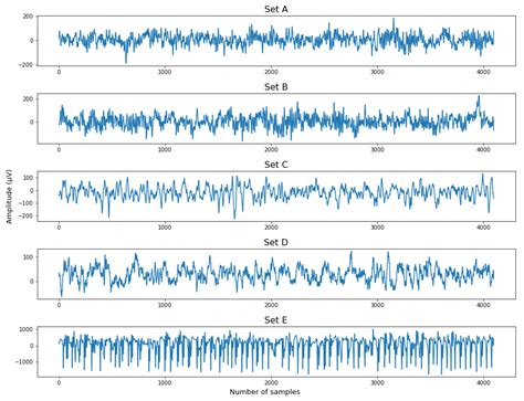 diagnostics free full text application of machine learning in epileptic seizure detection