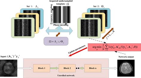 image reconstruction with self partition undersampled k space data download scientific diagram