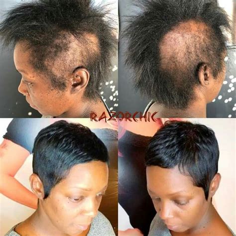 15 Alopecia Pixie Cut Short Hairstyle Trends Short Locks Hub
