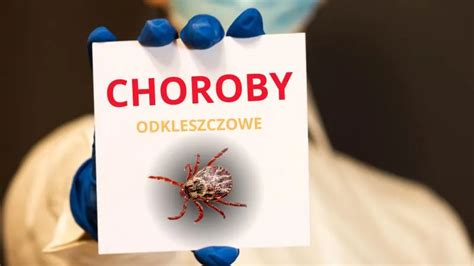 Jakie choroby przenoszą kleszcze Jak się przed nimi chronić