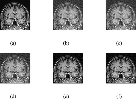 figure 1 from compressed magnetic resonance imaging based on wavelet sparsity and nonlocal total