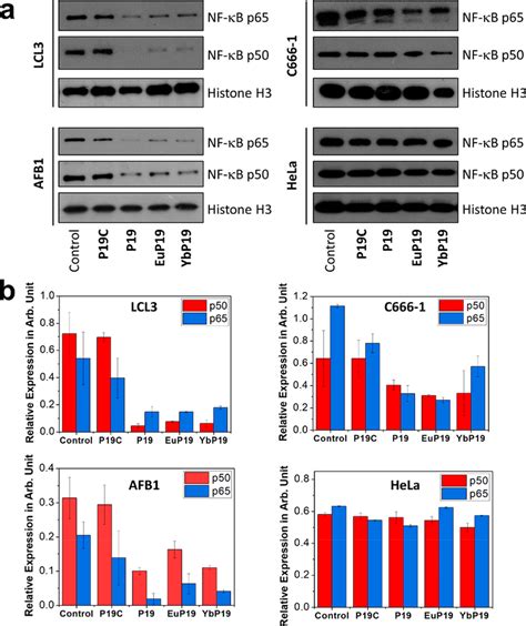 A Western Blot Results And B The Bar Charts Of NF KB P65 And P50 In