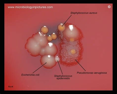 E Coli Colony Morphology
