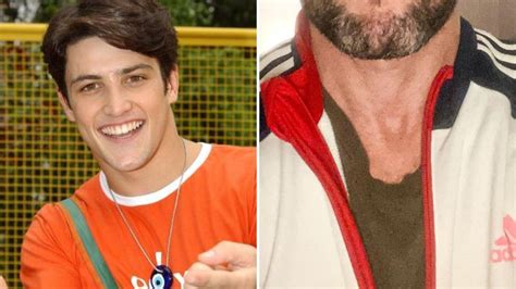 Lembra dele Ex galã de Malhação é atacado por visual envelhecido É