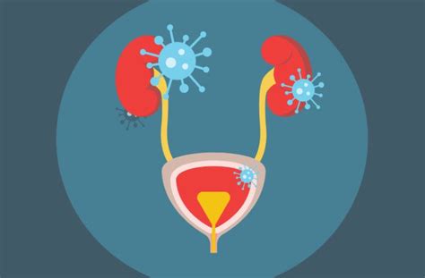 Urosepsis Penyebab Gejala Pengobatan Dan Pencegahan