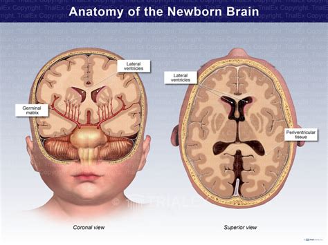 Anatomy Of The Newborn Brain TrialQuest Inc
