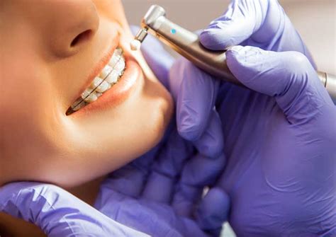 Cuáles son las fases de un tratamiento de ortodoncia Clínica dental