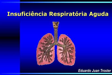 PPT Insuficiência Respiratória Aguda PowerPoint Presentation free