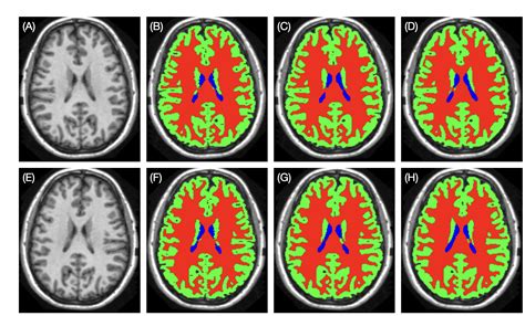 spectra group equivariant convolutional networks in medical image analysis