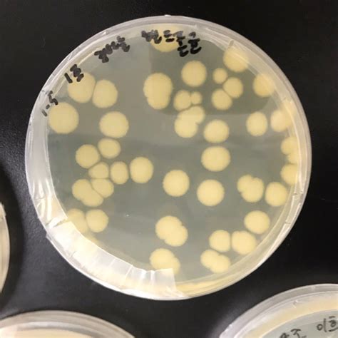 고체배지에 휴대폰균을 배양하여 육안으로 보이는 것이 정말 휴대폰에 있는 세균이 맞나요 BRIC