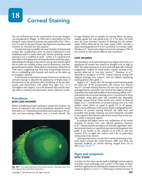 Corneal Staining Contact Lens Complications 1818 Corneal Staining The