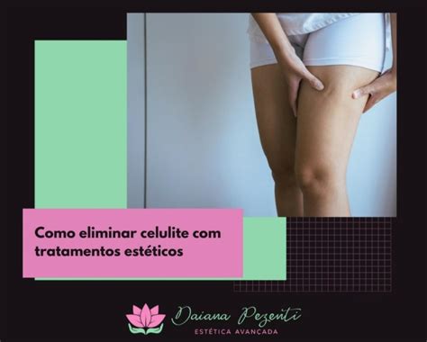 Como eliminar celulites tratamentos estéticos Blog Acqua Centro