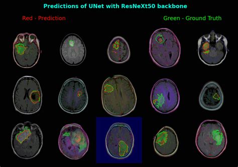 deep learning architectures for medical image segmentation eda aydin