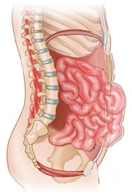 Premier Hernia Center Hernia Repair In Knoxville