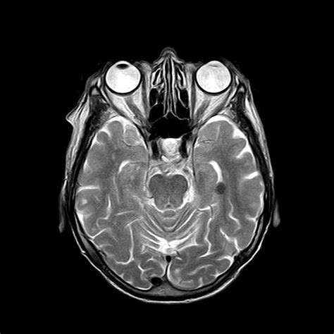 MRI Scans With Contrast And How They Differ From MRI Scans Without