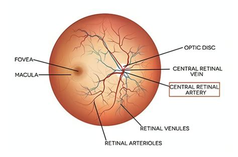 Central Retinal Artery Occlusion Symptoms Causes Diagnosis