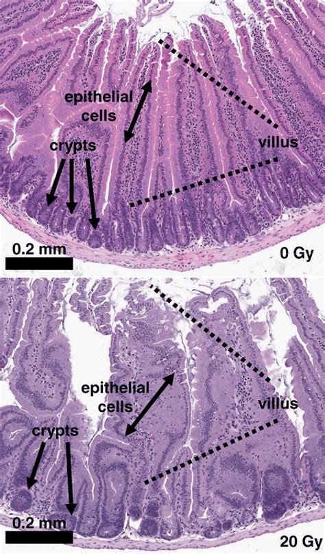 Small Intestine Histology Histology Slides Tissue Biology Human