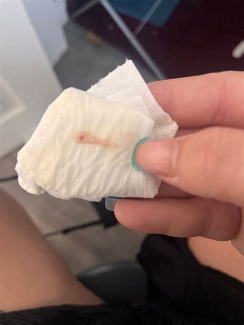 Implantation Bleeding Or Spotting Babycentre