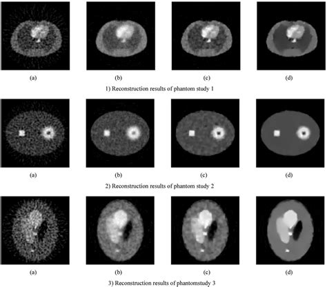 emission fbp reconstruction and bayesian reconstructions using download scientific diagram