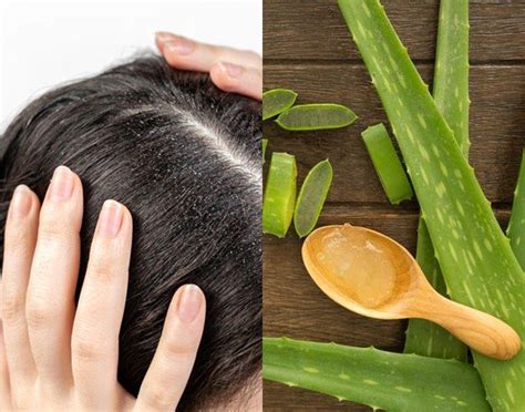 Intip 5 Manfaat Lidah Buaya Untuk Kesehatan Rambut Sehat