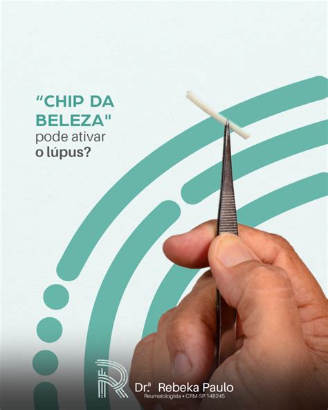 Tendinite no pé o que é causas e tratamento Dra Rebeka Paulo